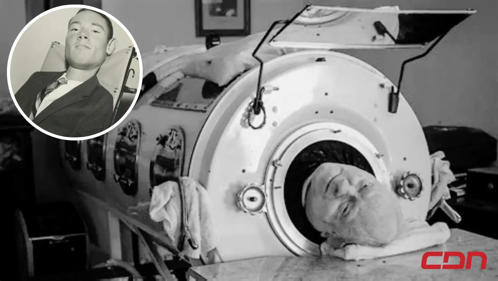 Fallece Paul Alexander tras vivir décadas en un pulmón de acero