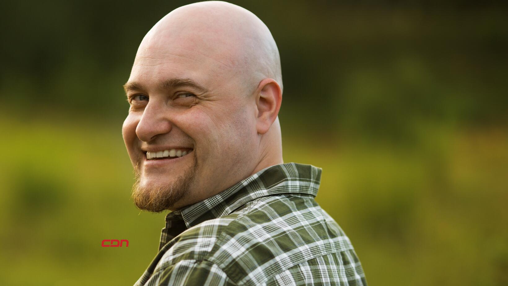 Día Mundial de los Calvos