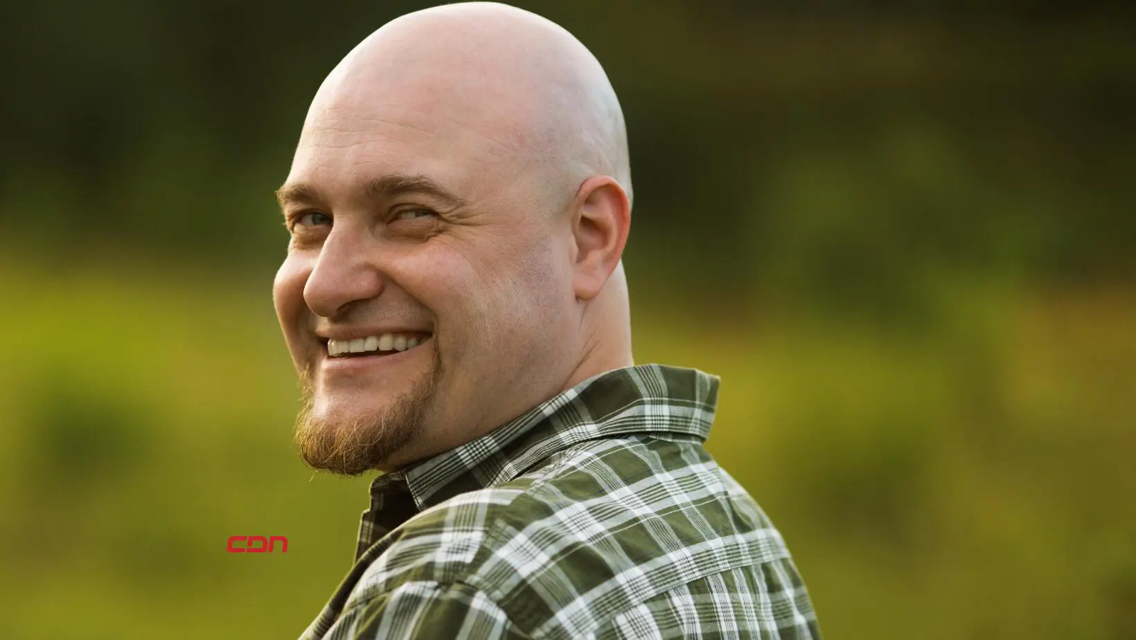 Día Mundial de los Calvos