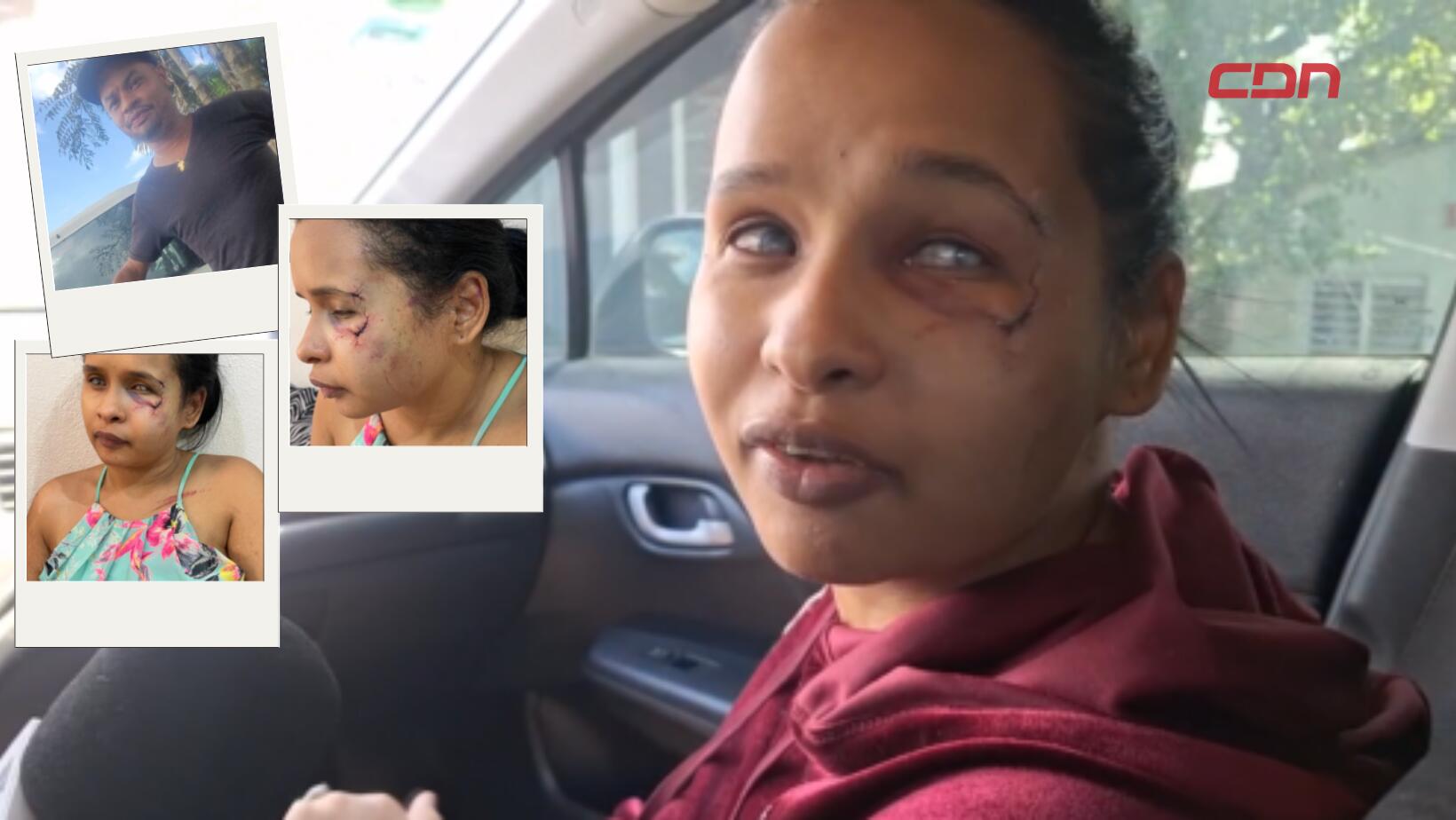 Mujer no vidente denuncia brutal agresión por parte de su expareja