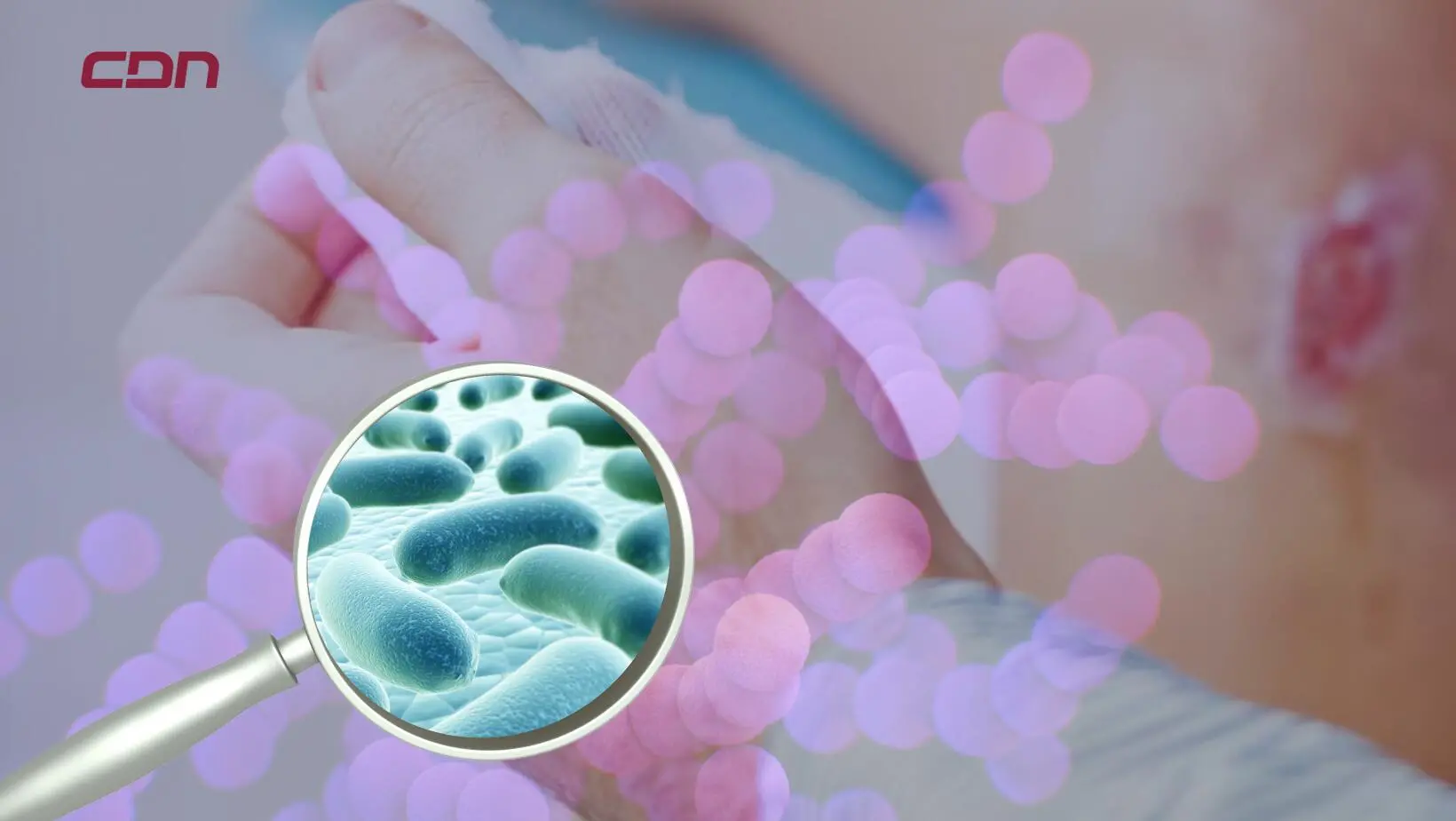 Bacteria “come carne”: Siete preguntas y respuestas